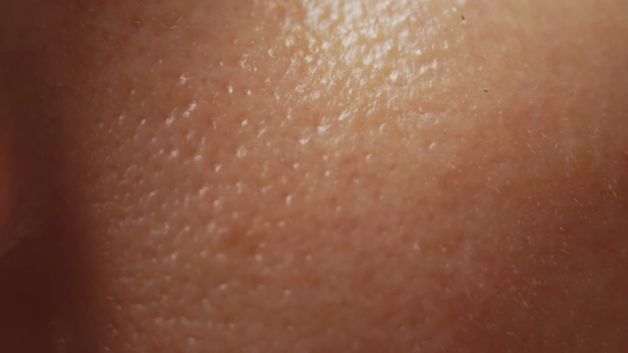 Large Pores on Nose, Big, Enlarged – How to Get Rid, Treat or Shrink